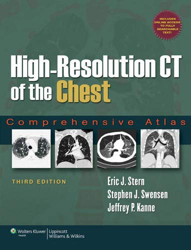 High-Resolution CT of the Chest: Comprehensive Atlas: 9780781791908 ...