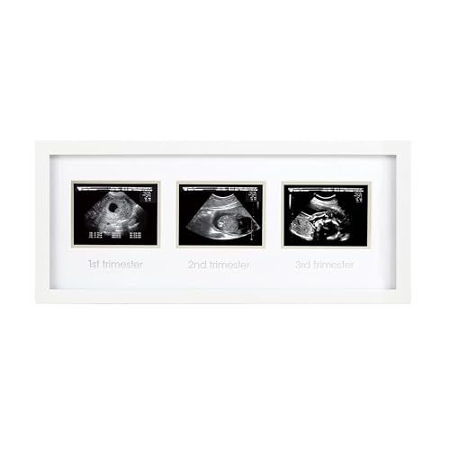 Pearhead Sonogram Progression Frame - Trimester by Trimester Pregnancy ...