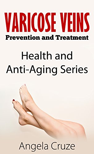 A Guide to Varicose Vein Prevention and Treatment (anti-aging): Health ...