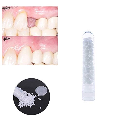 Temporary Dental Patch Temporary Dental Cement Capsules Teeth Temporary ...
