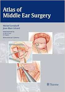 Atlas of Middle Ear Surgery: 9783131450418: Medicine & Health Science ...