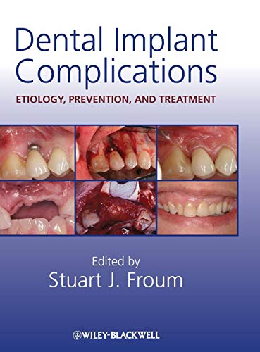 Dental Implant Complications: Etiology, Prevention, and Treatment ...