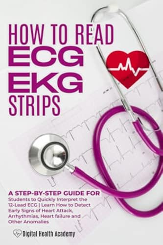 How to Read EKG/ECG Strips: A Step-By-Step Guide for Students to ...