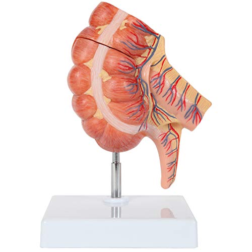 Mua Axis Scientific Caecum and Appendix Anatomy Model | Large Intestine ...