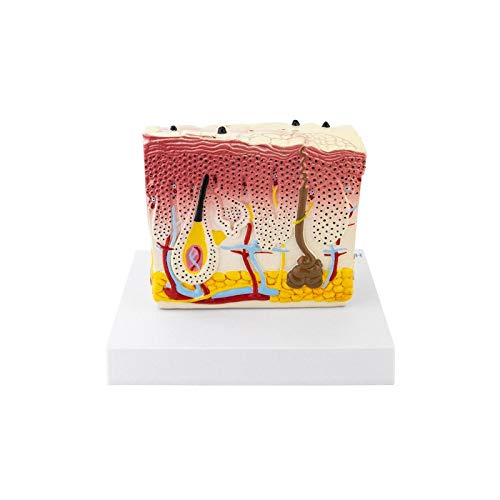 HeineScientific Skin Model with Psoriasis – BigaMart