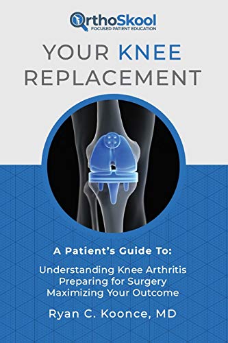 Your Knee Replacement: A Patient's Guide To: Understanding Knee ...