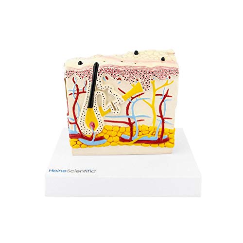 HeineScientific Skin Model with Psoriasis – BigaMart