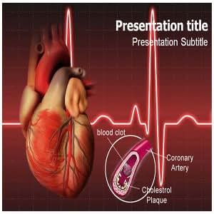 Amazon.com: Acute Coronary Syndrome PowerPoint Template - Acute ...