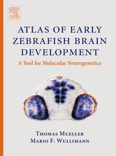 Atlas of Early Zebrafish Brain Development: A Tool for Molecular ...