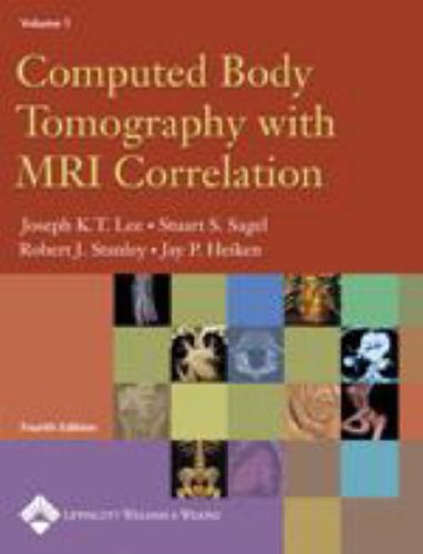 Computed Body Tomography with MRI Correlation (2 Volume Set ...