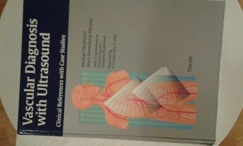 Vascular Diagnosis With Ultrasound : Clinical References With Case ...