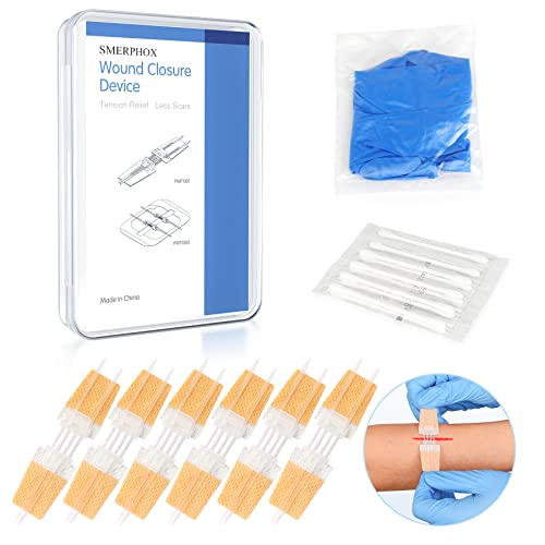 Wound Closure Strip, Sterile First Aid Kit, Zip Stitch Suture-Free ...