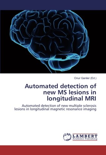 Automated detection of new MS lesions in longitudinal MRI: Automated detection of new multiple ...