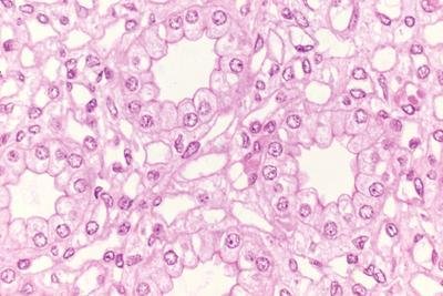 Simple Cuboidal Epithelium Is Found