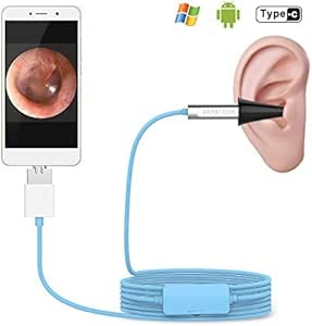 Amazon.com : DEPSTECH USB Otoscope, Digital Ear Scope Ear Inspection ...
