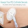 Peritoneal Dialysis PD Catheter Holder Adhesive Patch Stabilization ...