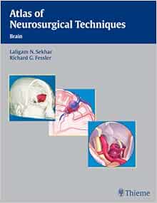 Atlas of Neurosurgical Techniques: Brain: 9780865779204: Medicine ...