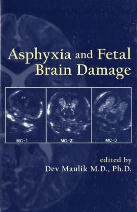 Asphyxia and Fetal Brain Damage: 9780471184270: Medicine & Health ...