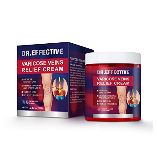 Varicose Veins Treatment For Legs-Varicose Veins Cream, Varicose Vein ...