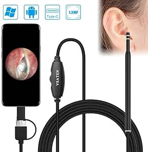 Amazon.com: VSATEN USB Otoscope, Digital Ear Camera 720HD Ear Scope ...