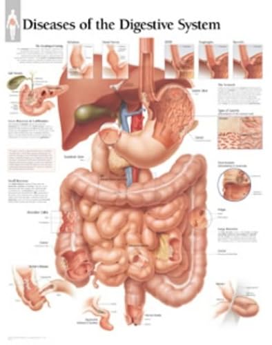 Diseases of Digestive System chart: Laminated Wall Chart in Kuwait ...