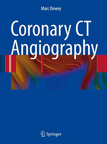 Coronary CT Angiography: 9783540798439: Medicine & Health Science Books ...