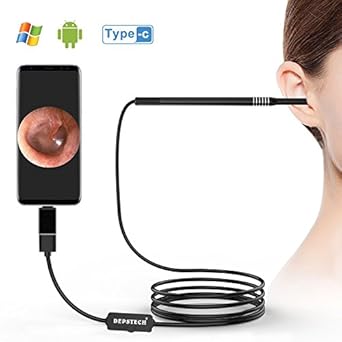 Amazon.com: Depstech Otoscope, 2 in 1 USB Ear Inspection Camera Earwax ...