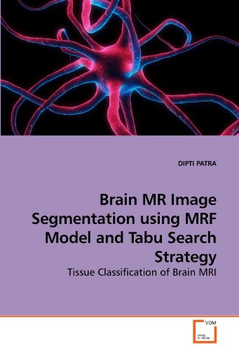 Buy Brain MR Image Segmentation using MRF Model and Tabu Search Strategy: Tissue Classification ...