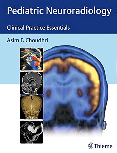 Pediatric Neuroradiology: Clinical Practice Essentials: 9781626230965: Medicine & Health Science ...