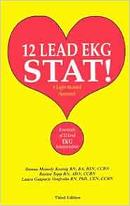 12 lead EKG stat! : a light-hearted approach : essentials of 12 lead ...