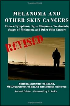 Melanoma And Other Skin Cancers: Causes, Symptoms, Signs, Diagnosis ...