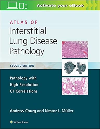 Pathology Outlines - Lung