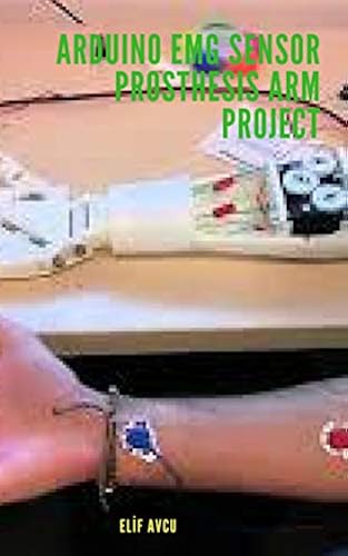 ARDUINO EMG SENSOR PROSTHESIS ARM PROJECT in Saudi Arabia | Whizz ...