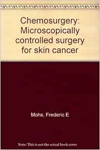 Chemosurgery: Microscopically controlled surgery for skin cancer: Mohs ...