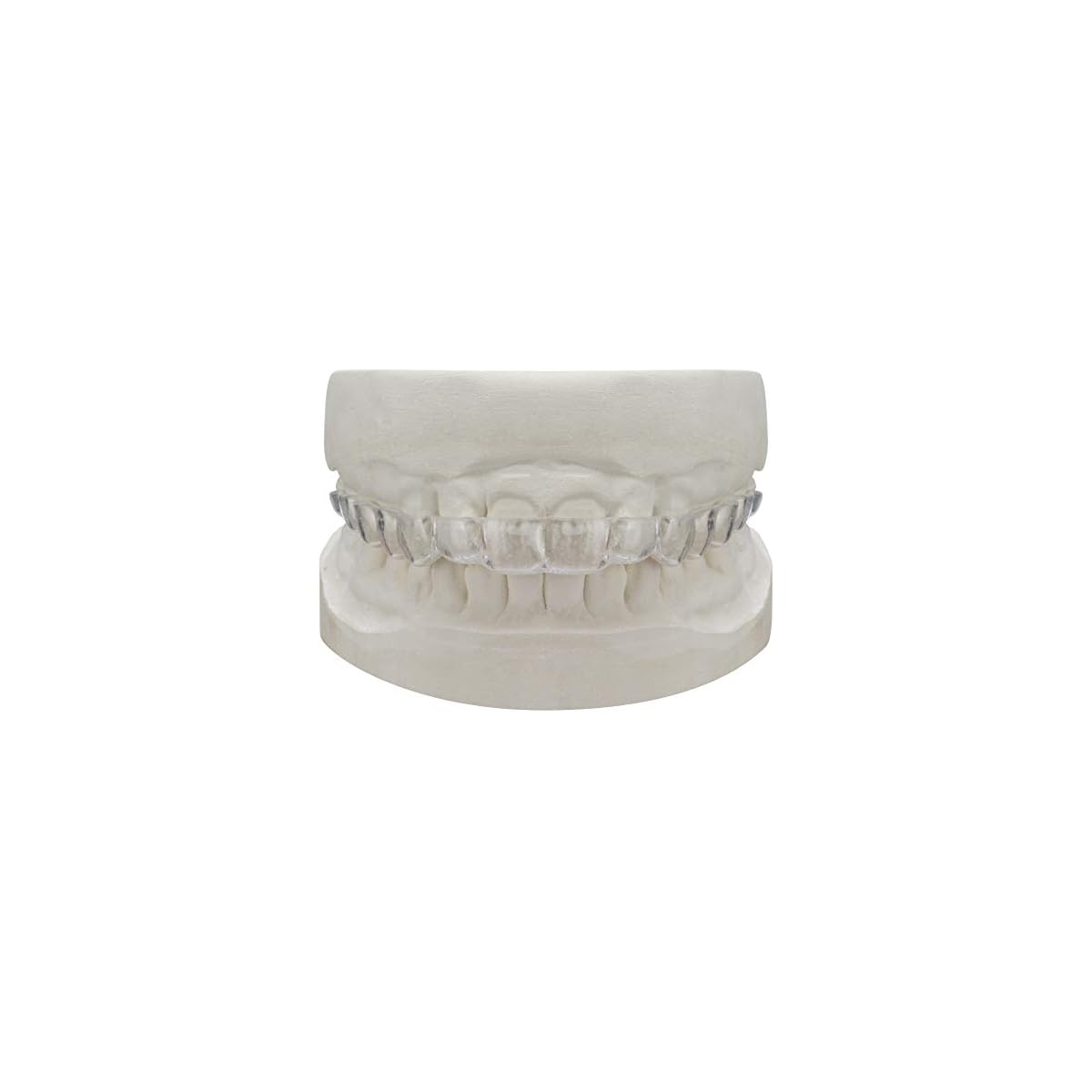 American DentalCraft Custom Dental Guard - Durable Acrylic Mouth Guard ...