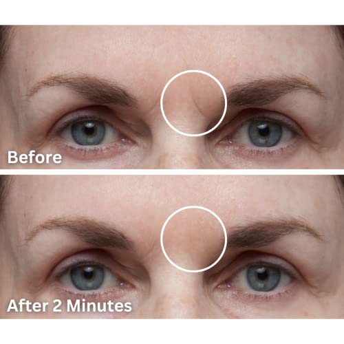 Dermaflage Scar Filler Kit - Tan - Deep Scar Cover And Waterproof ...