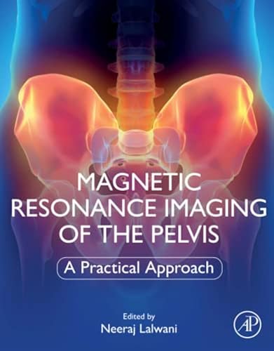 Magnetic Resonance Imaging of The Pelvis: A Practical Approach in Oman | Whizz Prostate Disease