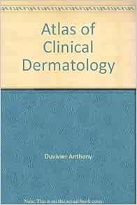 Atlas of Clinical Dermatology: 9780030114434: Medicine & Health Science ...