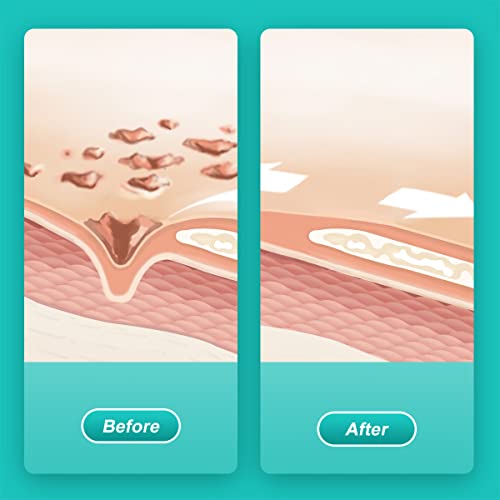 Dimora 2 Packs 6oz Hydrogel First Aid Ointment, Burn Injory Soothing ...