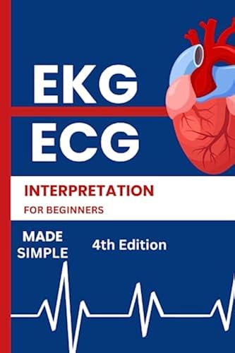 EKG/ECG INTERPRETATION FOR BEGINNERS: A beginner's perfect guide to ...