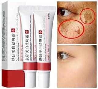 2pcs Whitening Freckle Cream, Acne Scar Removal Treatment Cream ...
