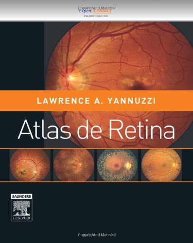 Atlas de Retina PDF Lawrence A. Yannuzzi