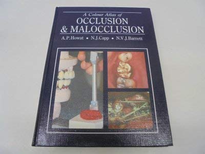 A Colour Atlas of Occlusion and Malocclusion: 9780723415381: Amazon.com ...