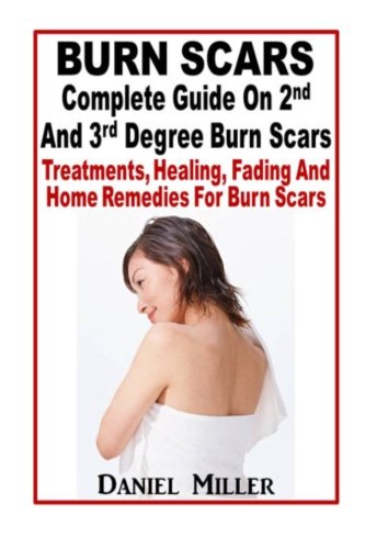 Burn Scars : Complete Guide On 2nd And 3rd Degree Burn Scars ...