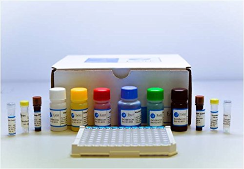 Buy Creatinine Assay Kit (urine normalizing assay) Online at ...