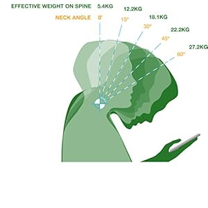 The Backpod - Direct Treatment and Ongoing Care for Upper Back and Neck ...