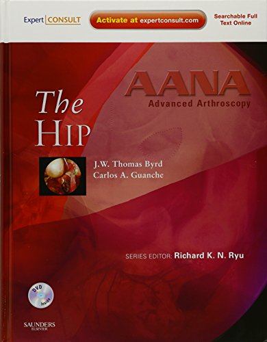 AANA Advanced Arthroscopy: The Hip: Expert Consult: Online, Print and ...