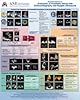 Evaluation of Prosthetic Valves with Echo and Doppler Ultrasound Poster ...