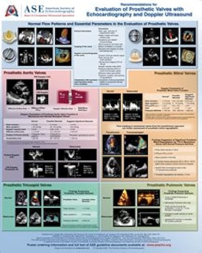 Evaluation of Prosthetic Valves with Echo and Doppler Ultrasound Poster ...