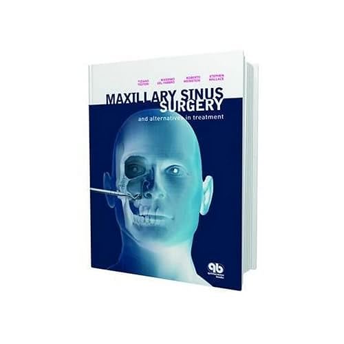 Maxillary Sinus Surgery and Alternatives in Treatment in Oman | Whizz ...